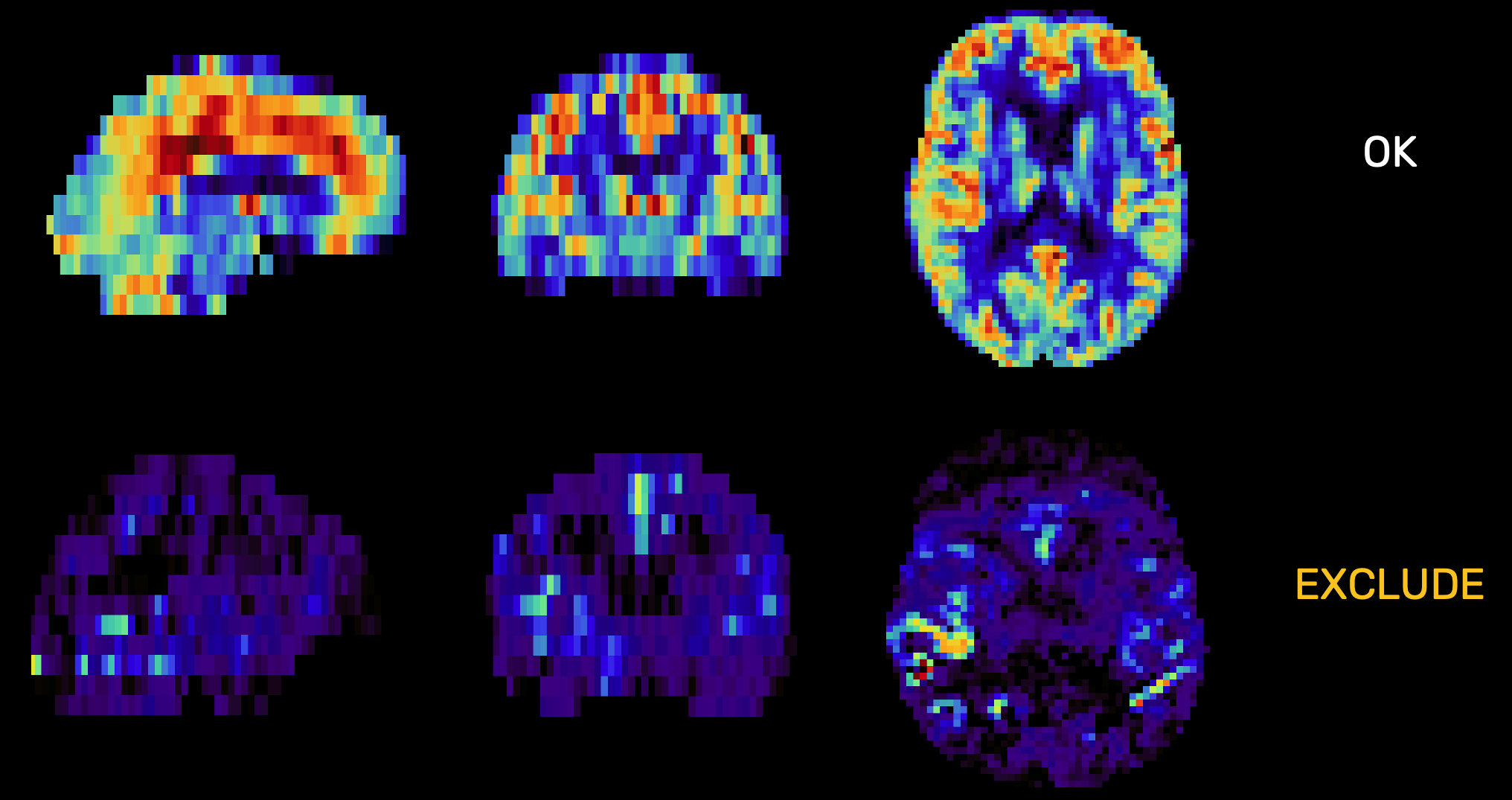 Clinical Trials Imaging – Quantified Imaging